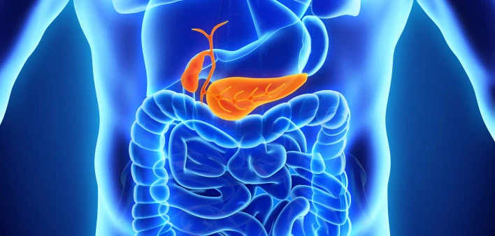 Cancerul de pancreas, un cancer care nu dă semne în faze incipiente ...